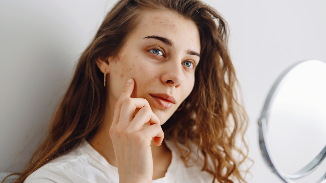 5 signs on skin that can tell you’re dehydrated