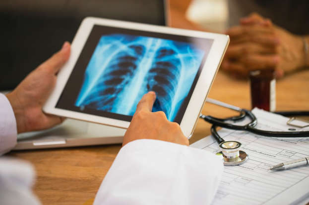 Lung cancer is on the rise among non-smokers – here’s why Lung cancer is on the rise among non-smokers – here’s why
