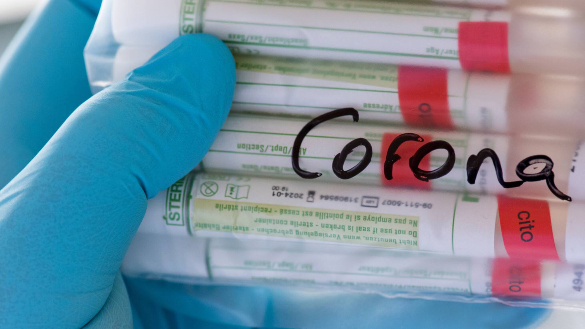 Corona: Omikron – der Wendepunkt der Corona-Pandemie? Corona: Omikron – der Wendepunkt der Corona-Pandemie?