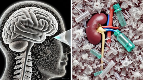 Plastic in your brain? New study finds 4-5 paper clips worth of ...