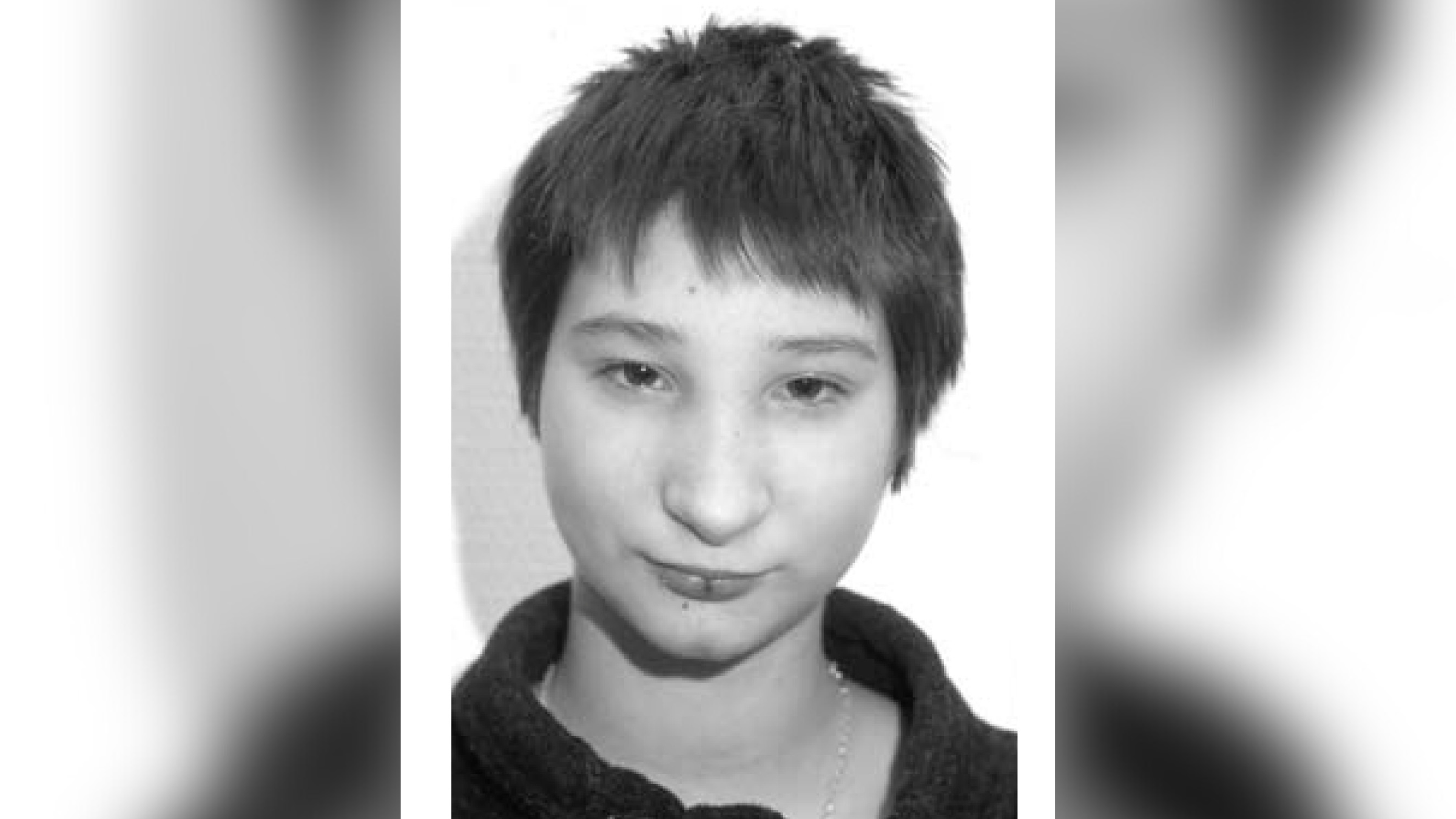 People with this rare genetic condition can't repair damage to their DNA