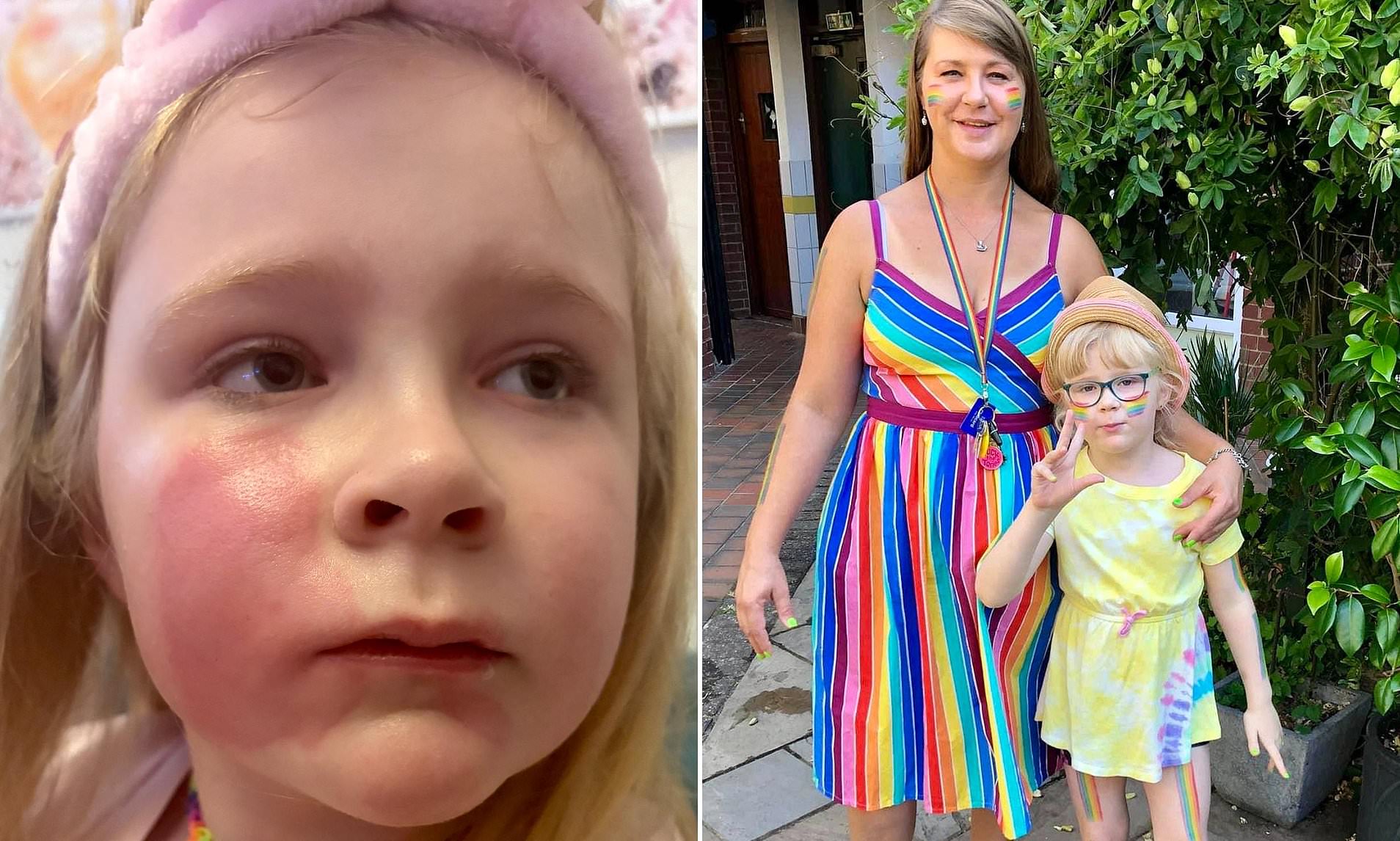 Warning over popular makeup item after toddler left with burns