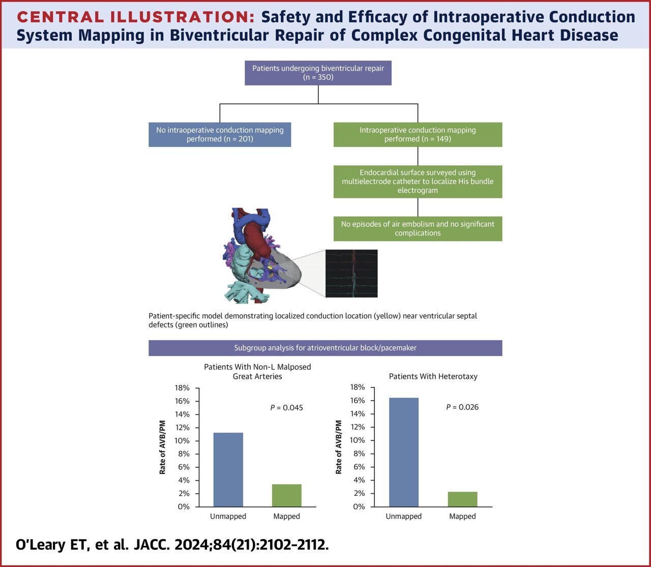 Conduction tissue mapping is shown to significantly reduce heart block