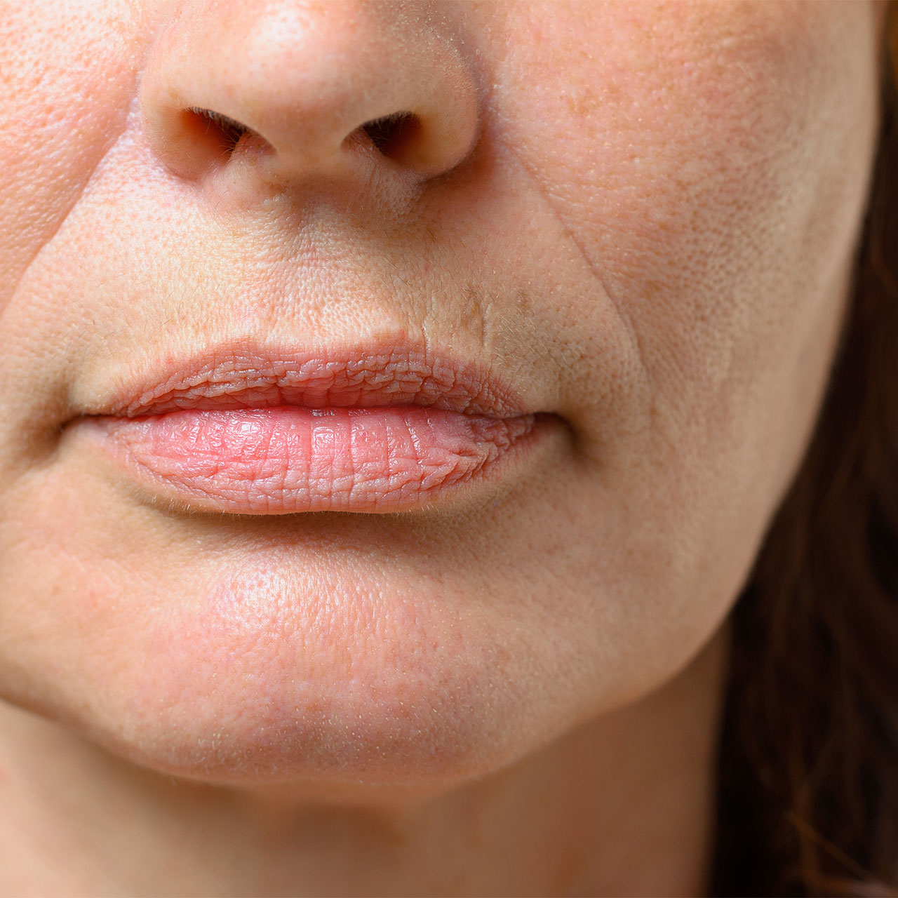 8 Common Signs Your Body Is Low In Collagen