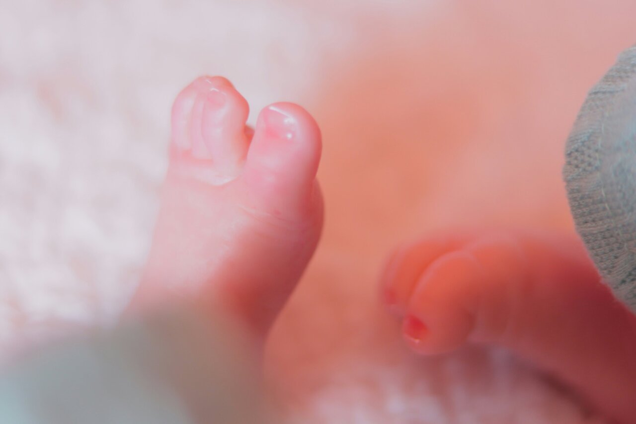 Actor David Tennant has an extra toe. Two anatomists explain what's so ...