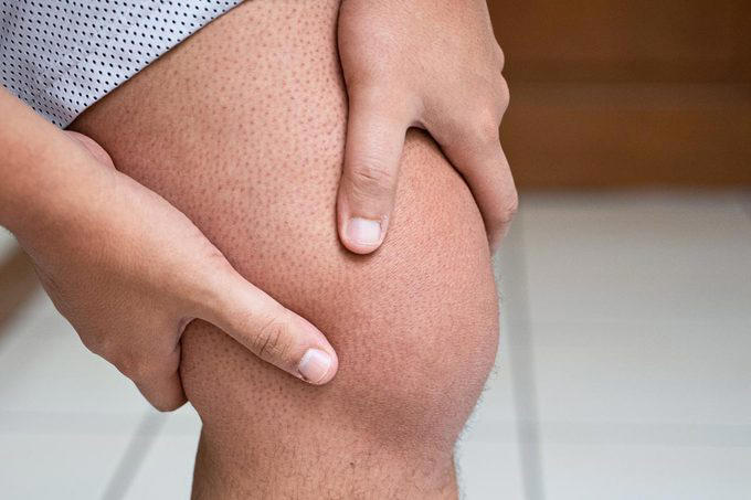 8 Causes for Pain Behind the Knee (And How to Treat It)