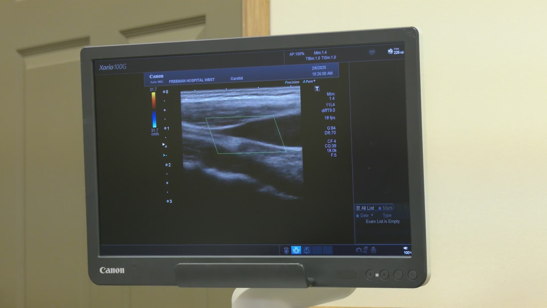 Medical Focus: Heart Screenings