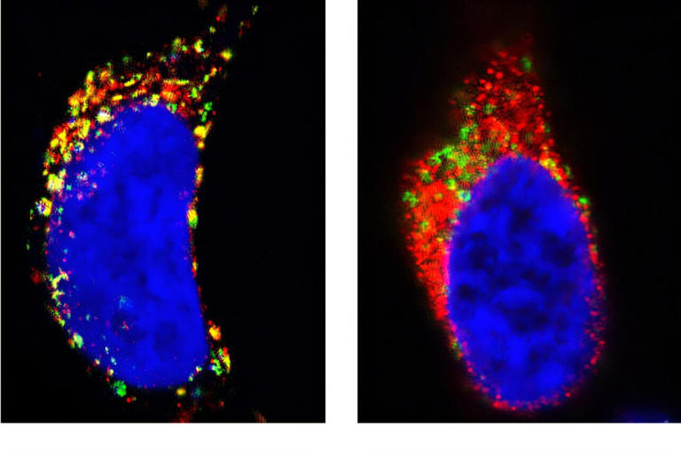 The short and long of protein tails: How they aid membrane insertion ...