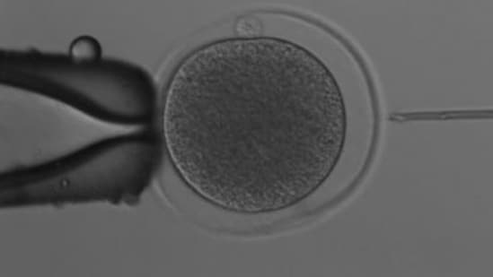 Australian scientists successfully create first-ever kangaroo embryo ...