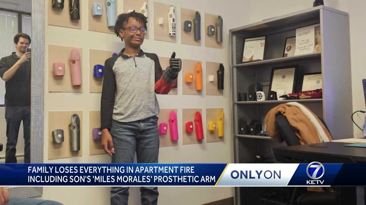 Child with limb difference loses prosthetic Miles Morales arm in fire