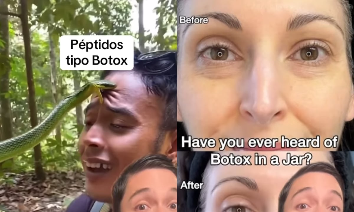 IMPRESIONANTE: Así usan el veneno de serpiente como botox para eliminar ...