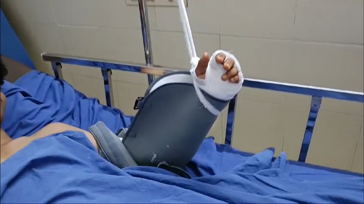 New Kerala ragging case: School student's hand broken for ‘not ...