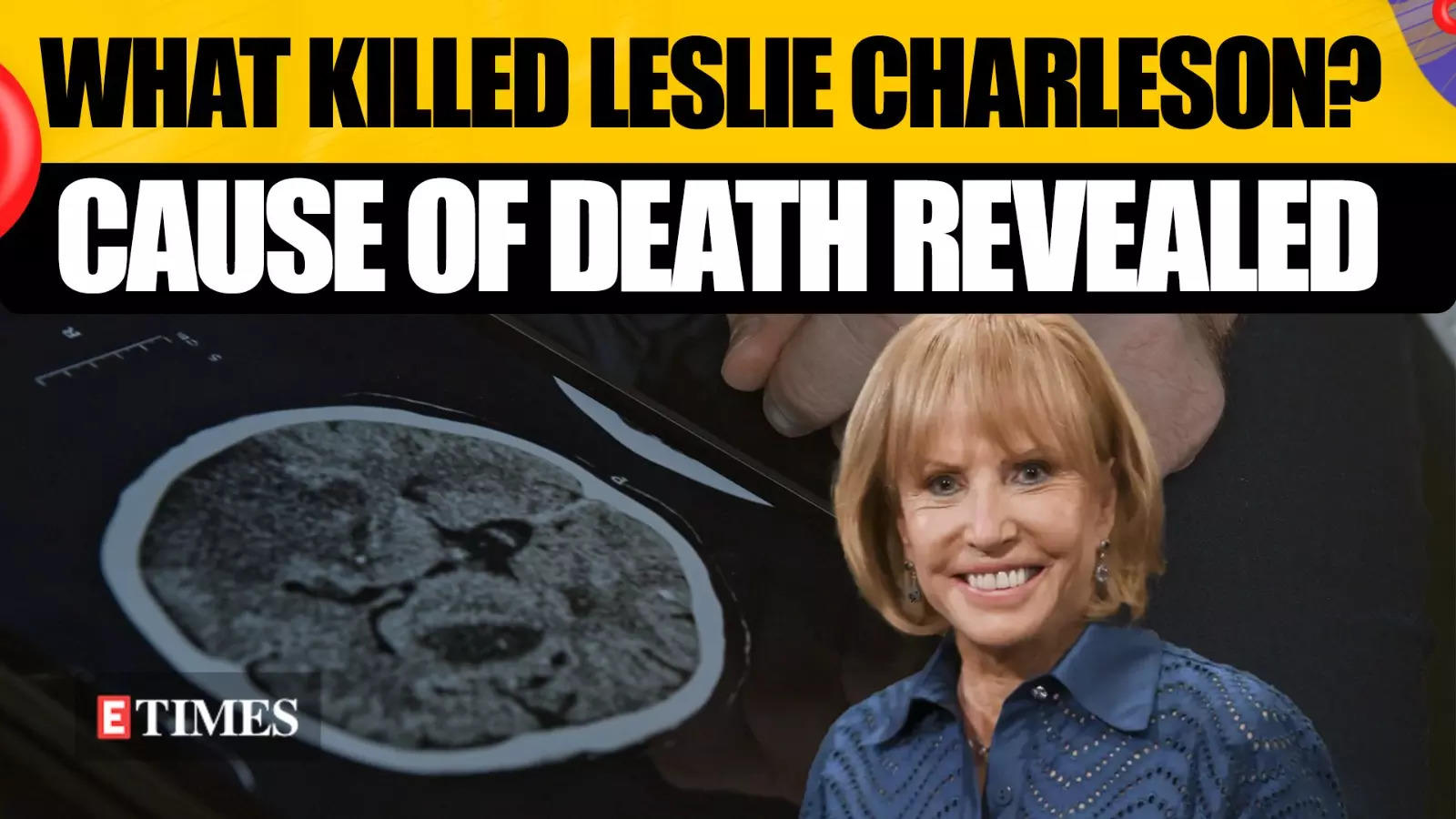 General Hospital Star Leslie Charleson’s Cause of Death Revealed a ...