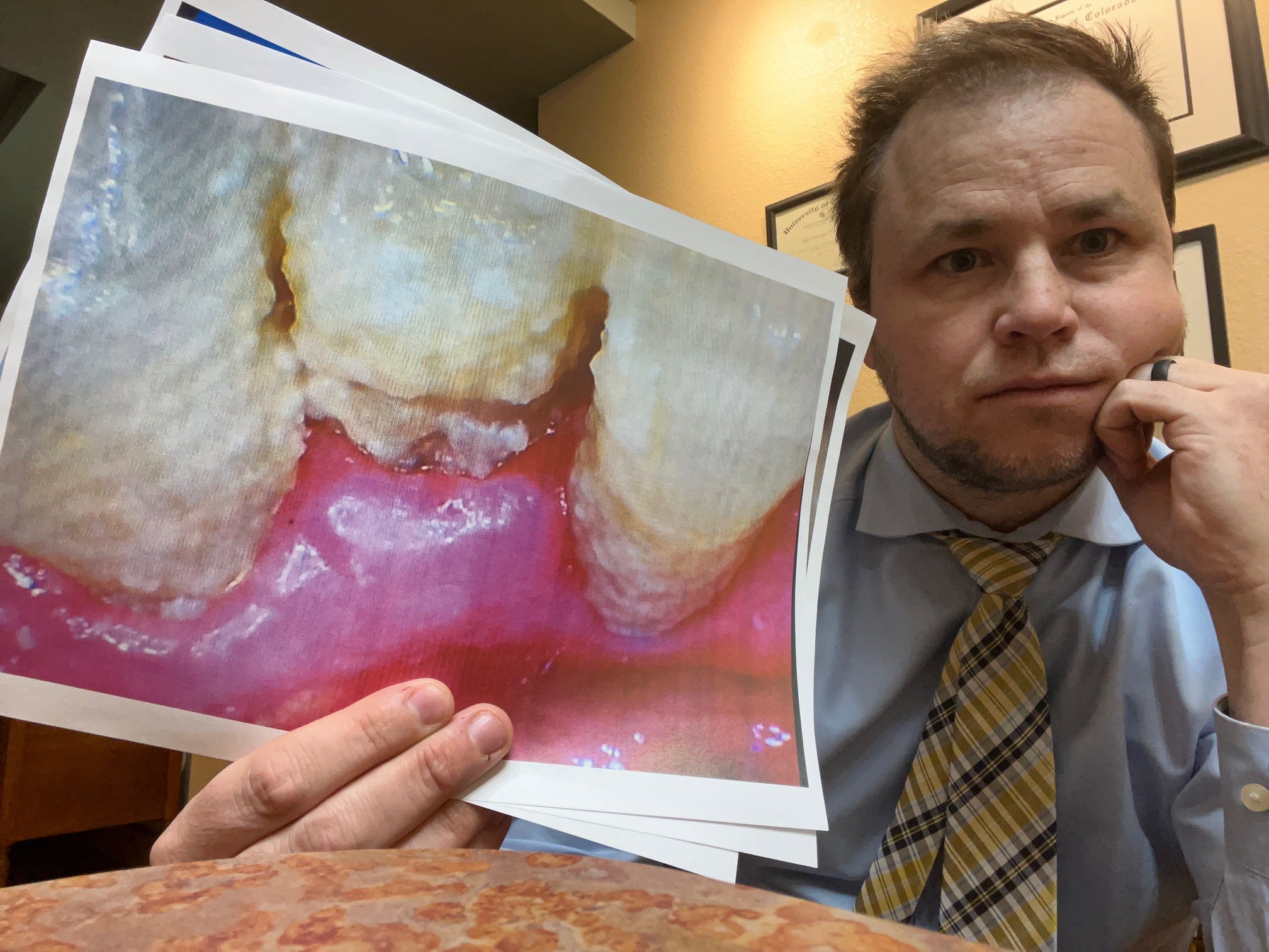 Colorado dentist rips Humana after elderly man's routine teeth cleaning ...