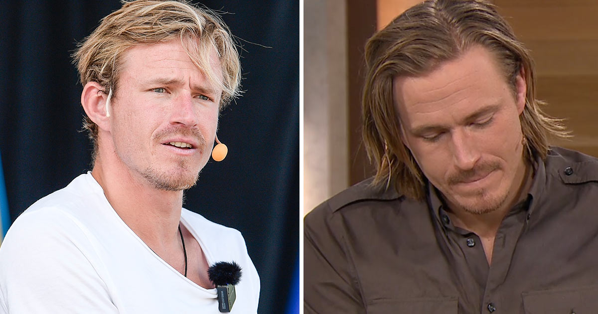 Aron Anderson om problemen med hälsan efter brännskadan