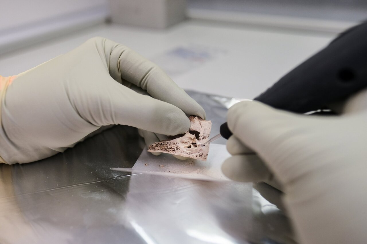 Genetic heritage from the Stone Age protects against today's chronic ...