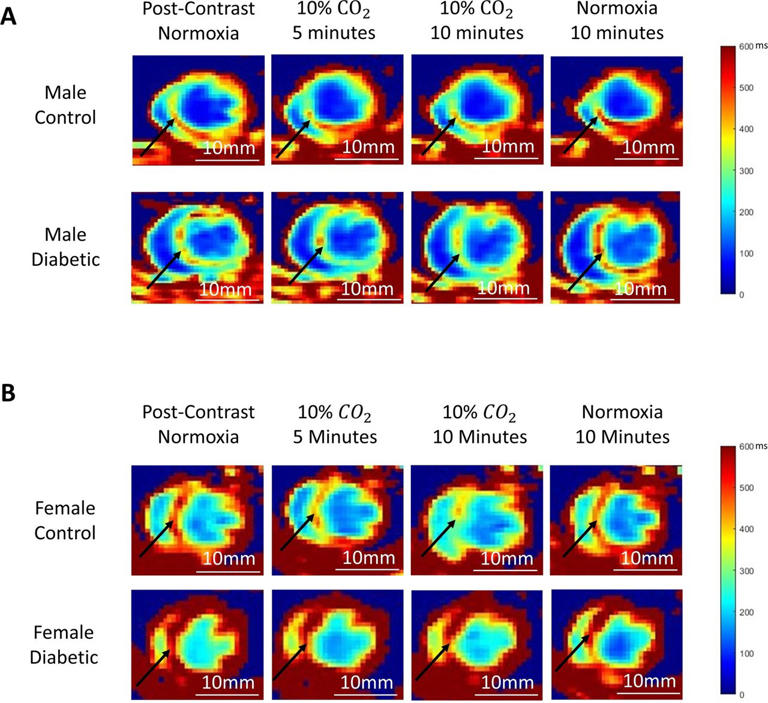 Leg muscle may serve as an early warning system for heart failure ...