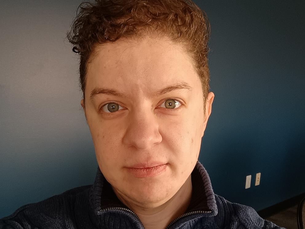 States move to restrict transgender adult care