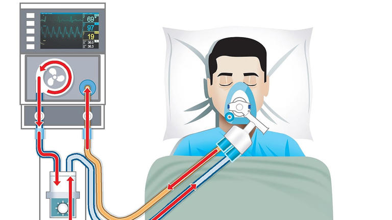 Hospitals in Kerala prolong life support for brain-dead patients ...