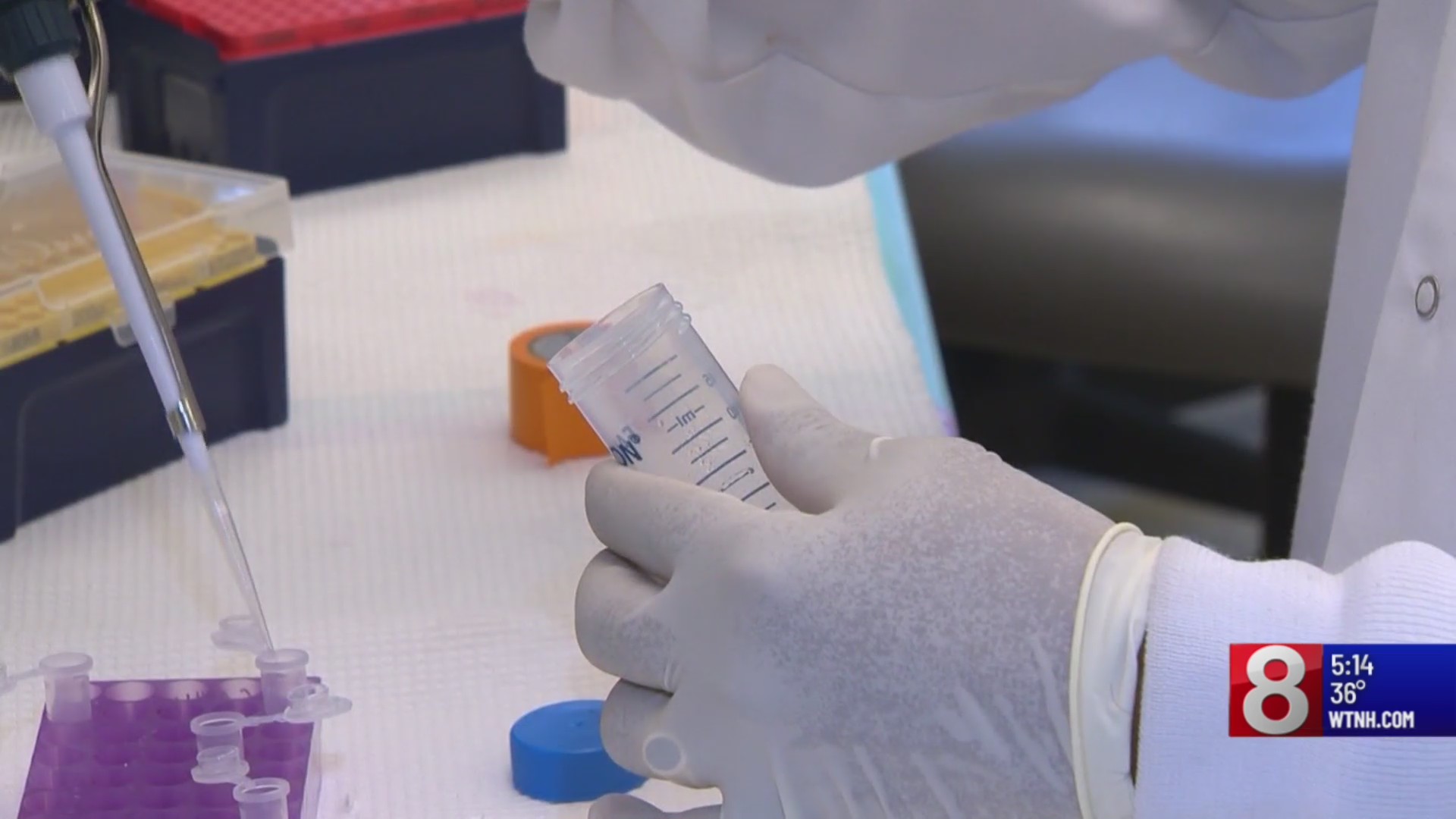 Black History Month: Sickle cell disease research underway at Yale