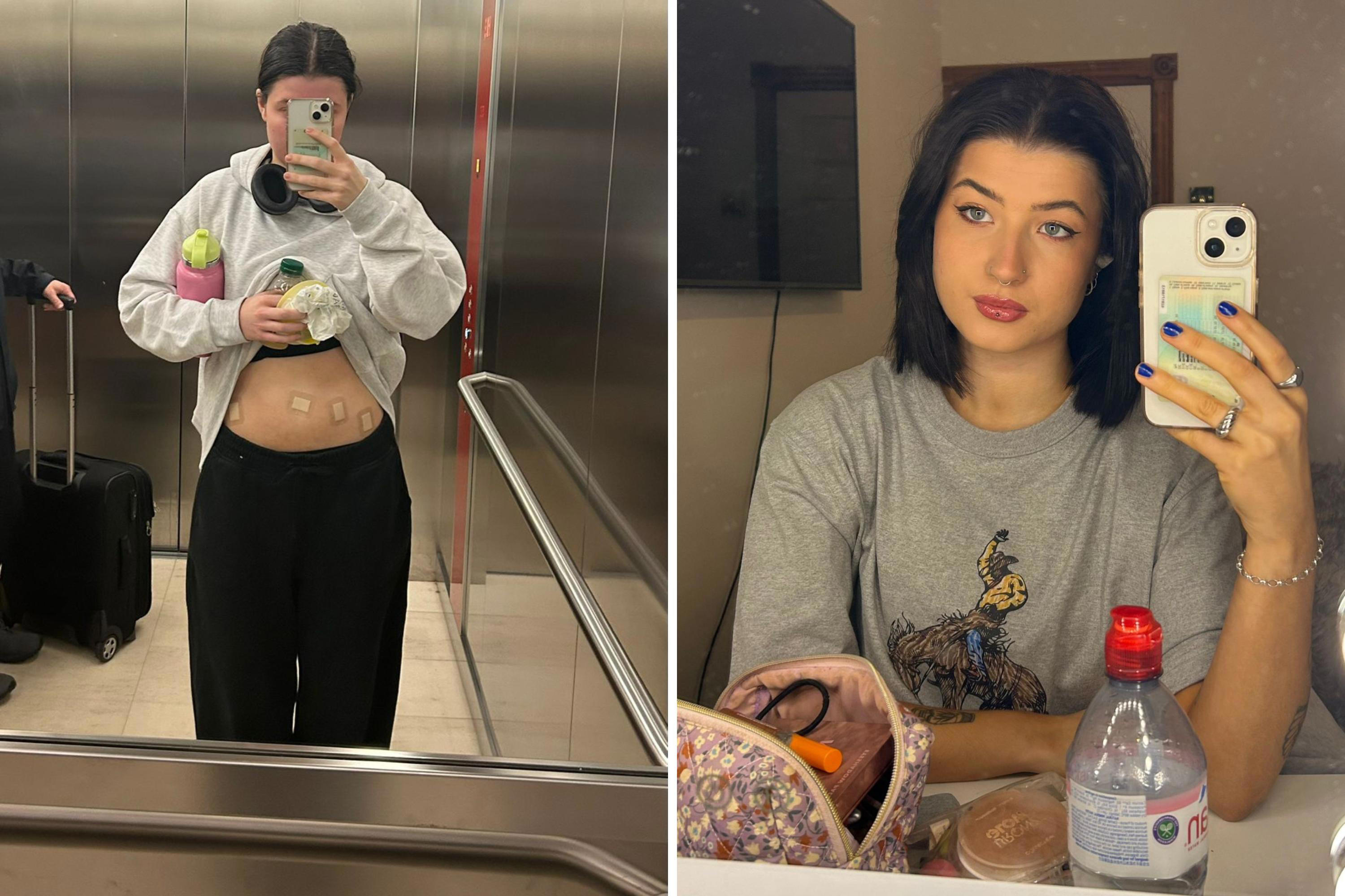 Gen Z Woman's Worst Fears Confirmed After 8 Year Struggle for Diagnosis Gen Z Woman's Worst Fears Confirmed After 8 Year Struggle for Diagnosis