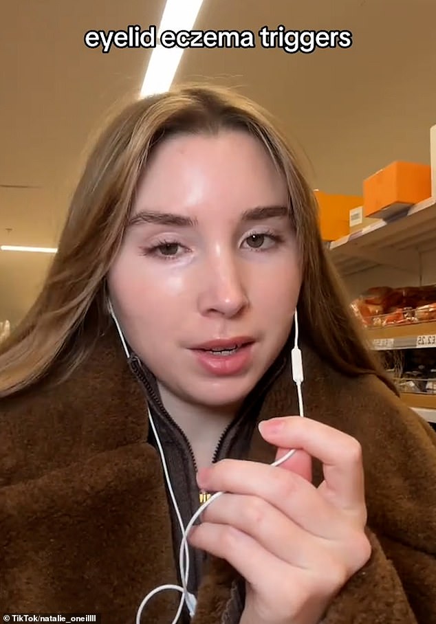 Blogger reveals common finger accessories that can lead to eye eczema