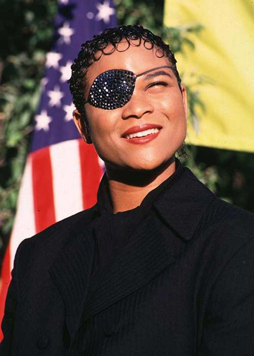 What happened to singer Gabrielle's eye?