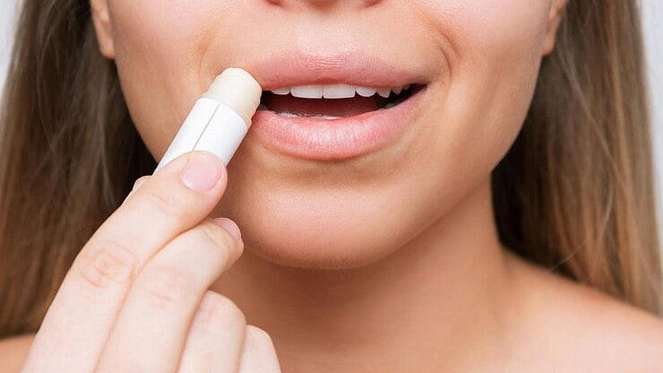 5 Easy Hacks To Heal Chapped Lips Naturally