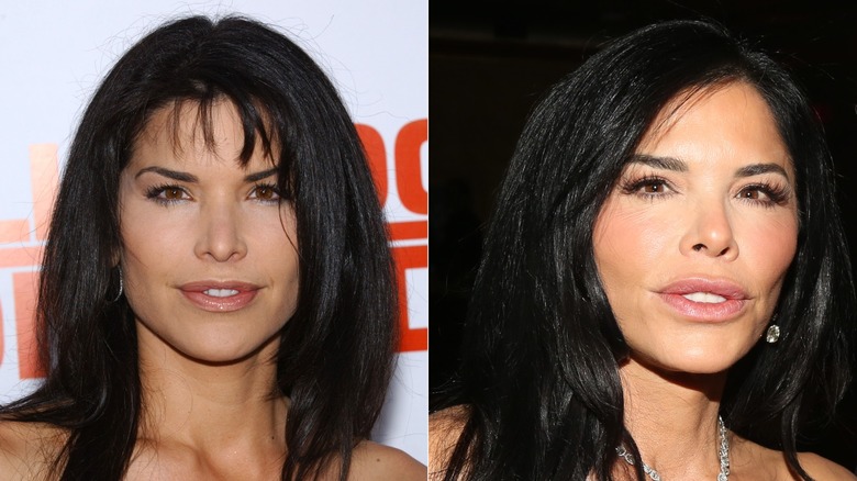 Lauren Sánchez Looked So Different Before All The Plastic Surgery