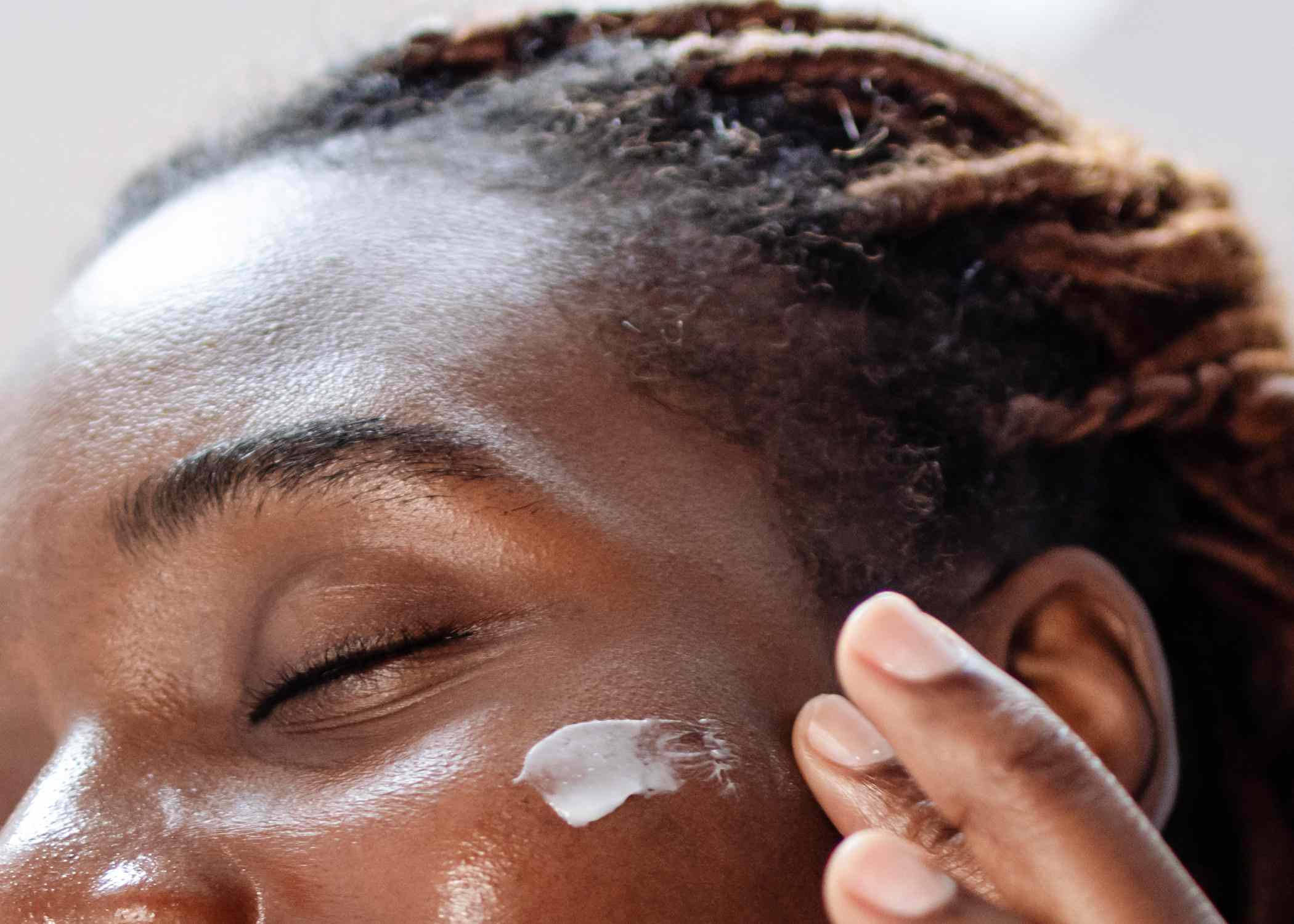 What Non-Comedogenic Ingredients Mean for Acne-Prone Skin