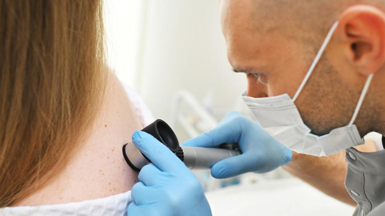 Warning Signs Your Red Skin Could Be Cancer