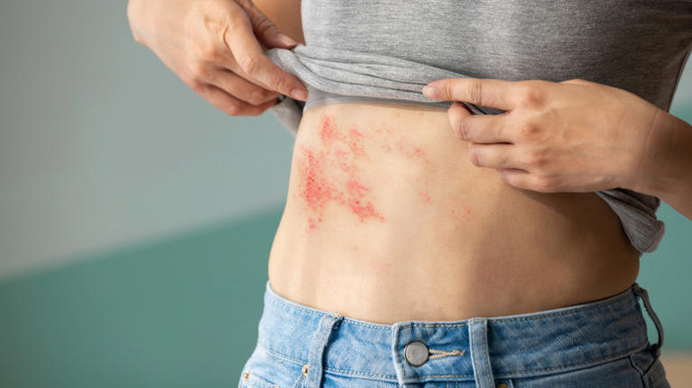 Warning Signs Your Red Skin Could Be Cancer