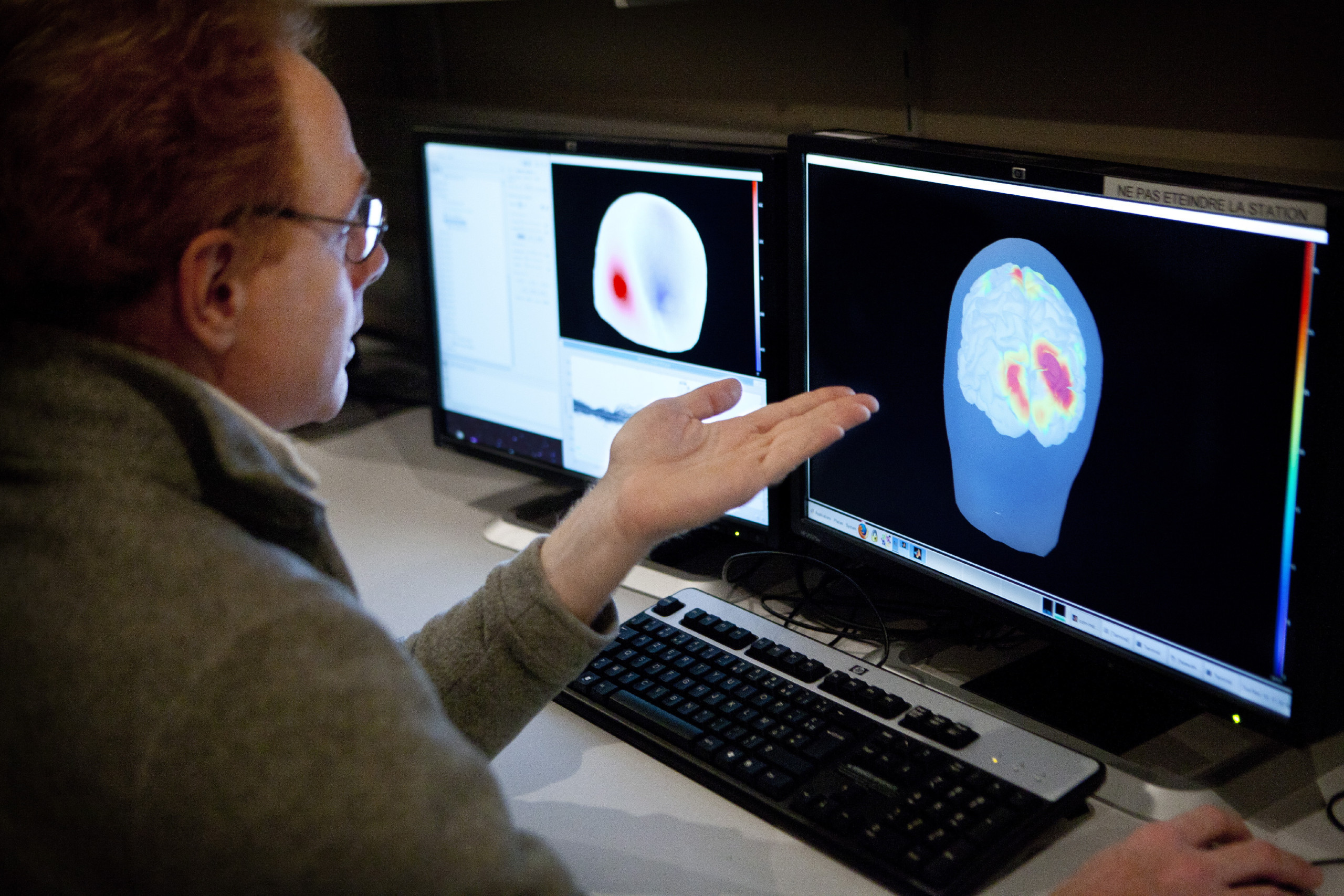 Troubles neurologiques : comment les identifier et les expliquer