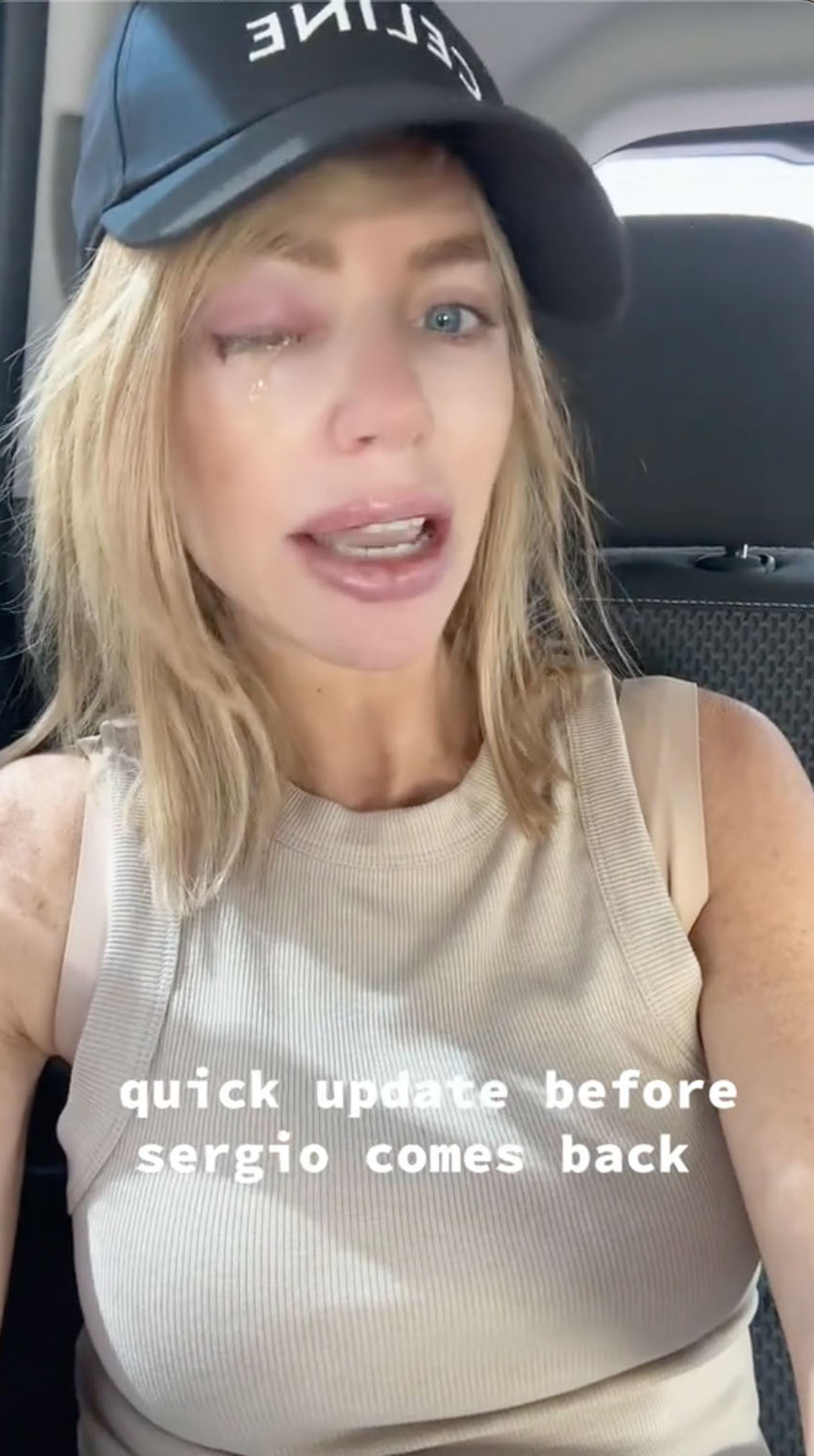 Caroline Stanbury says her eye ‘might burst’ as it oozes in squeamish ...