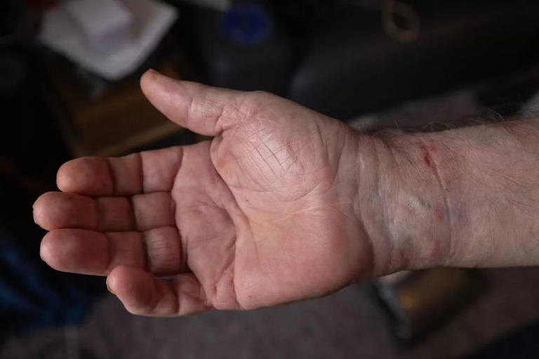 Pensioner handcuffed by police while trying to find wife 'missing' from ...