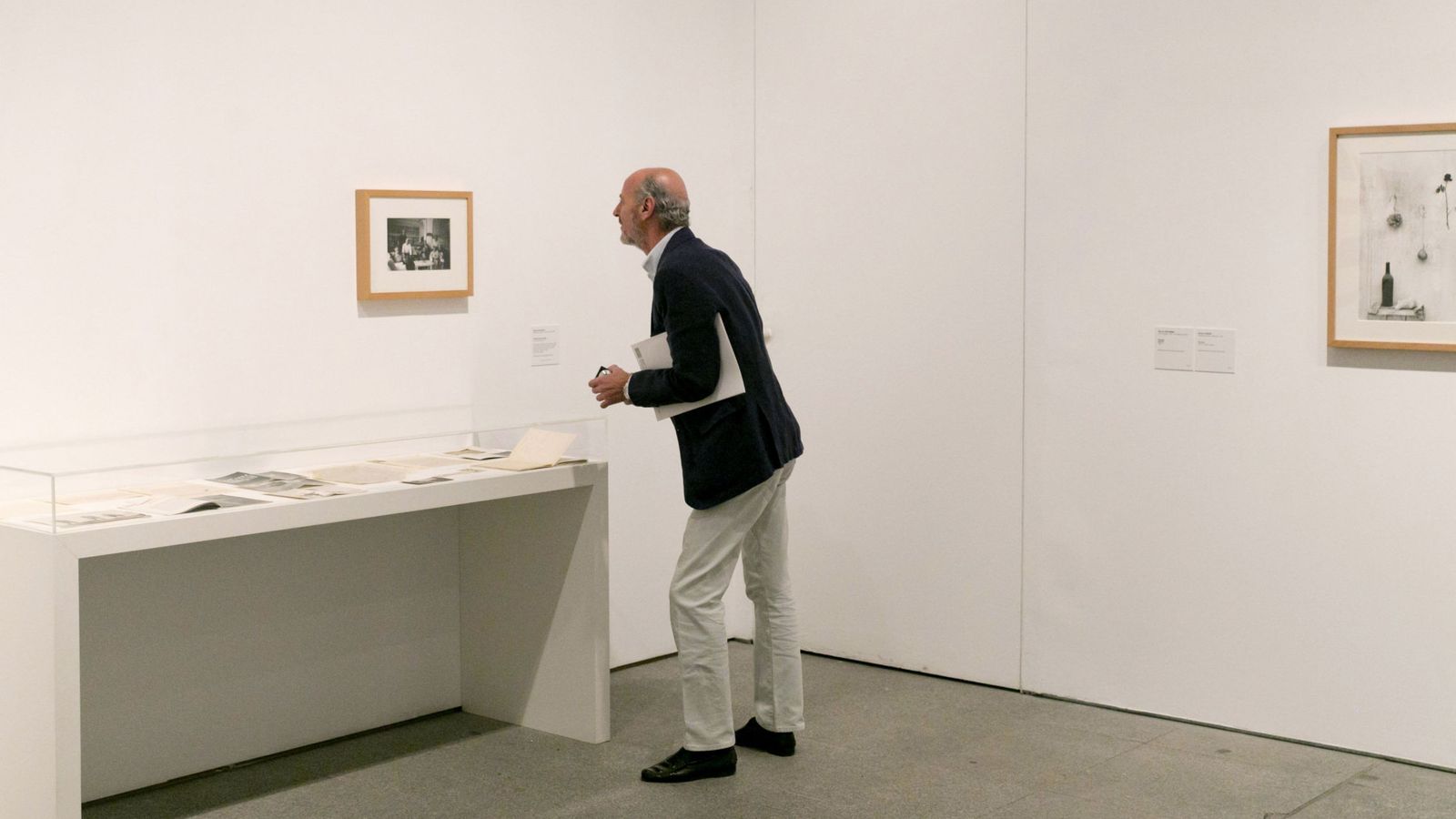 Ni fachas, ni rojos: España es un país de calvos