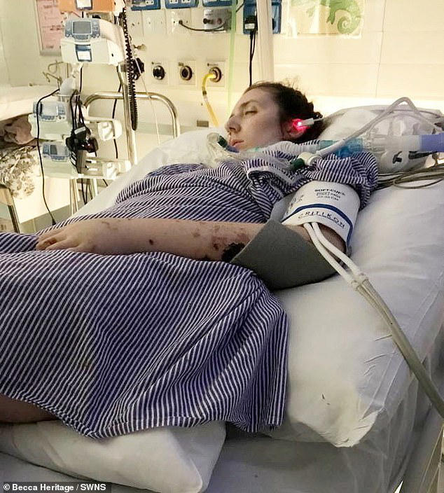 Student had a rare hand transplant to help her become a doctor