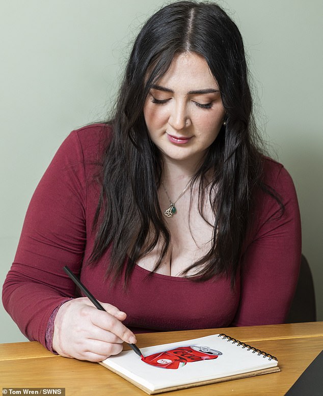 Student had a rare hand transplant to help her become a doctor