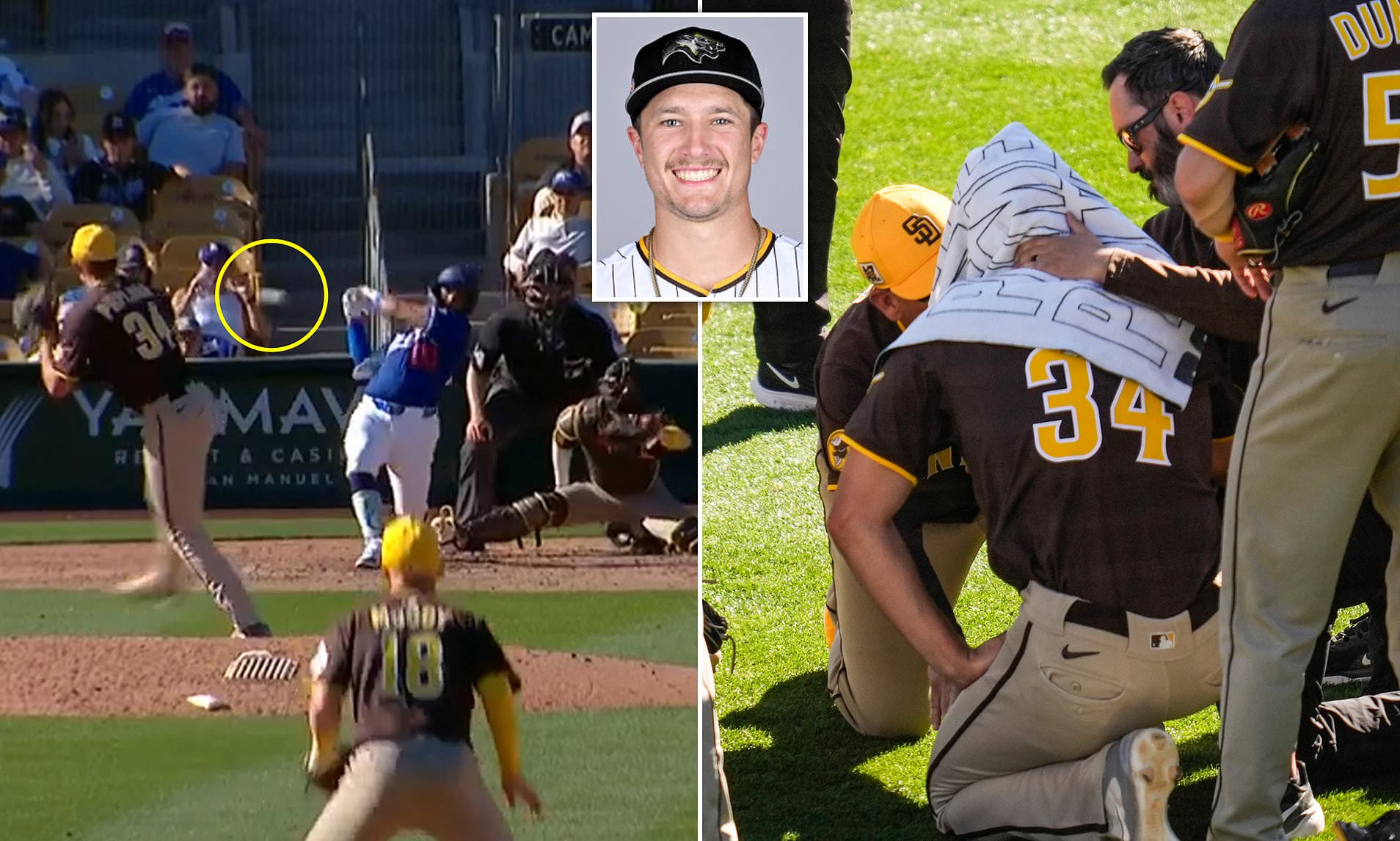 Padres pitcher takes 102.4MPH line drive off his face in frightening ...