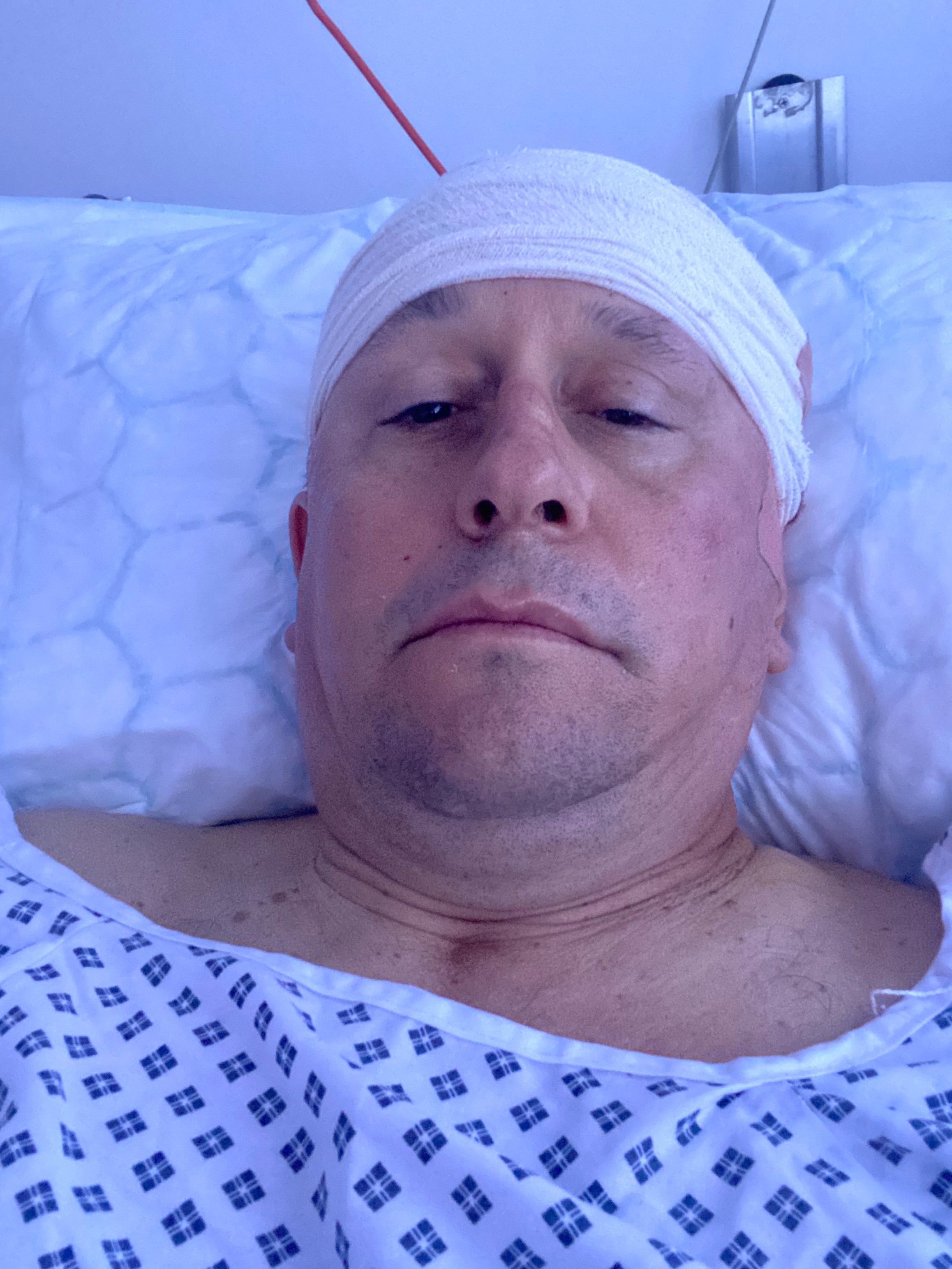 Keen runner who woke with bruises all over his body told he has months ...