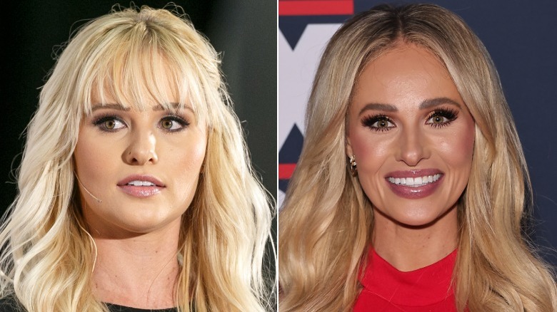 Cosmetic Expert Spills On Fox News Star Tomi Lahren's Overdone Face Changes