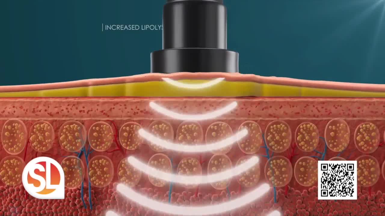 Slim down and contour your body with Cellsound at Nuvell Clinics in ...