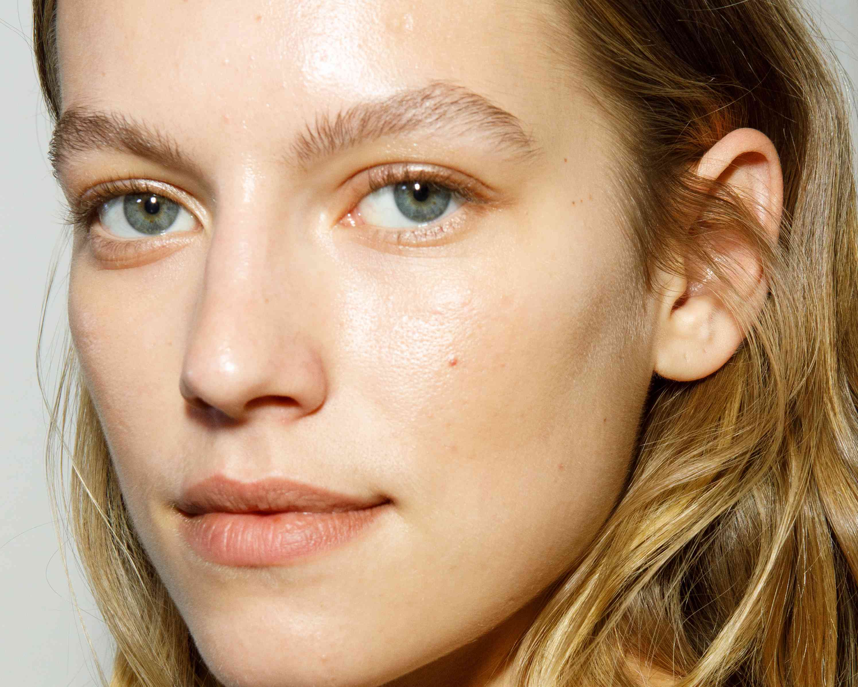 How to Heal Cracked Lip Corners Fast, According to Dermatologists