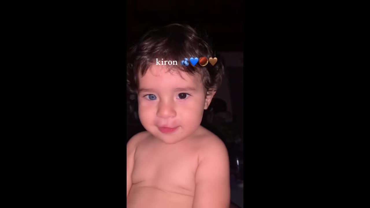 11-month-old baby with heterochromia stuns with unique eyes in viral ...
