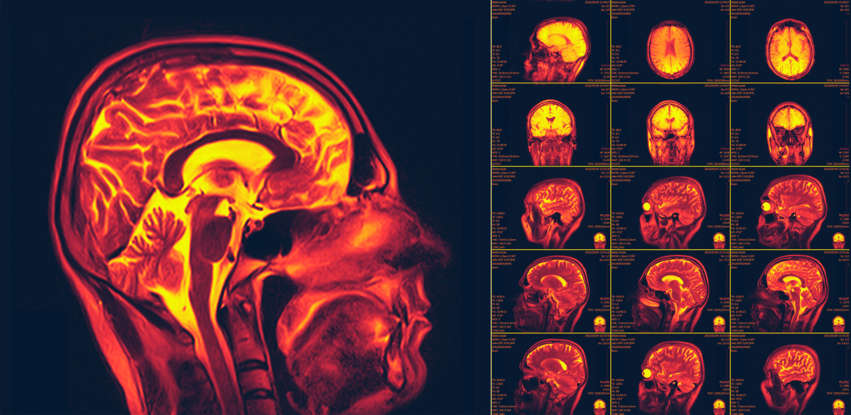 Surprising ways hormones affect our bodies Surprising ways hormones affect our bodies