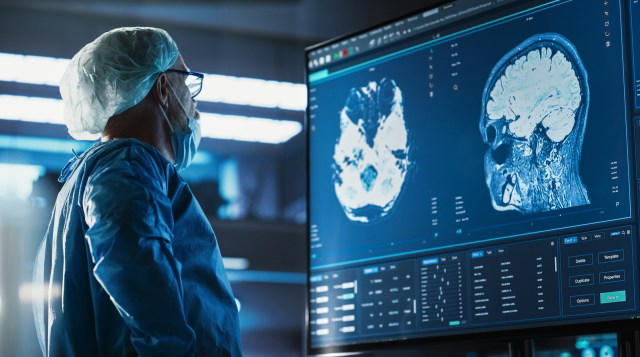 Researchers issue warning after discovering troubling trend in human brains: 'A much larger ...