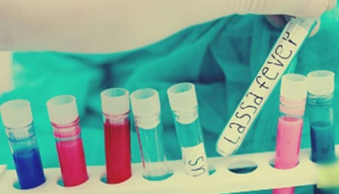 Lassa Fever Outbreak In Nigeria: 80 Dead Across 11 States As Health ...