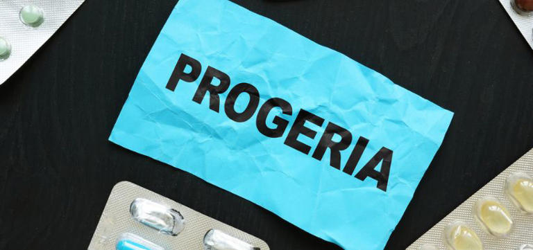 Progéria : causes, espérance de vie et espoirs de traitement