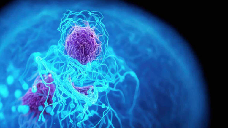 AstraZeneca's metastatic breast cancer treatment gets EU nod