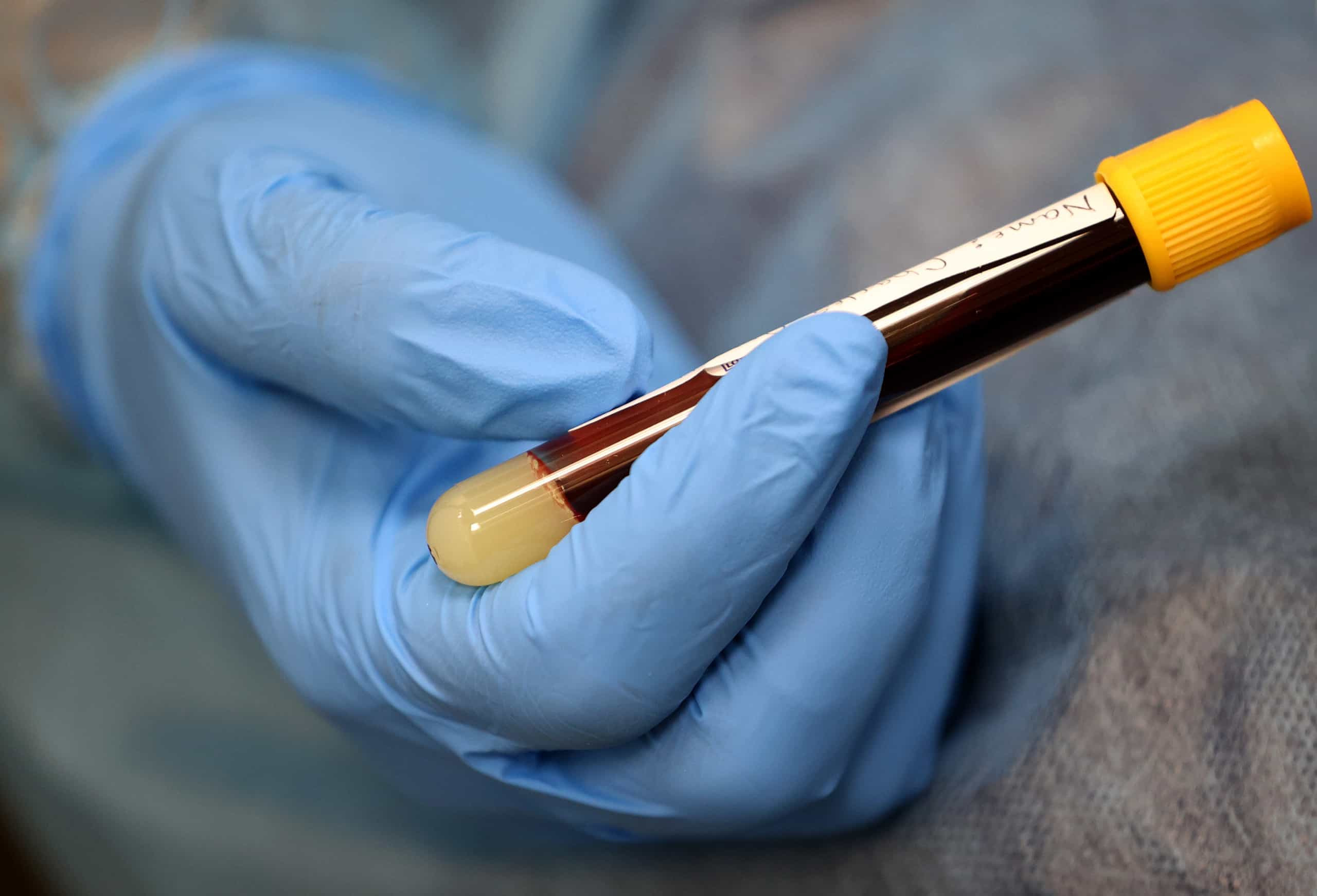 The "toxic cocktail" of chemicals invading our bodies